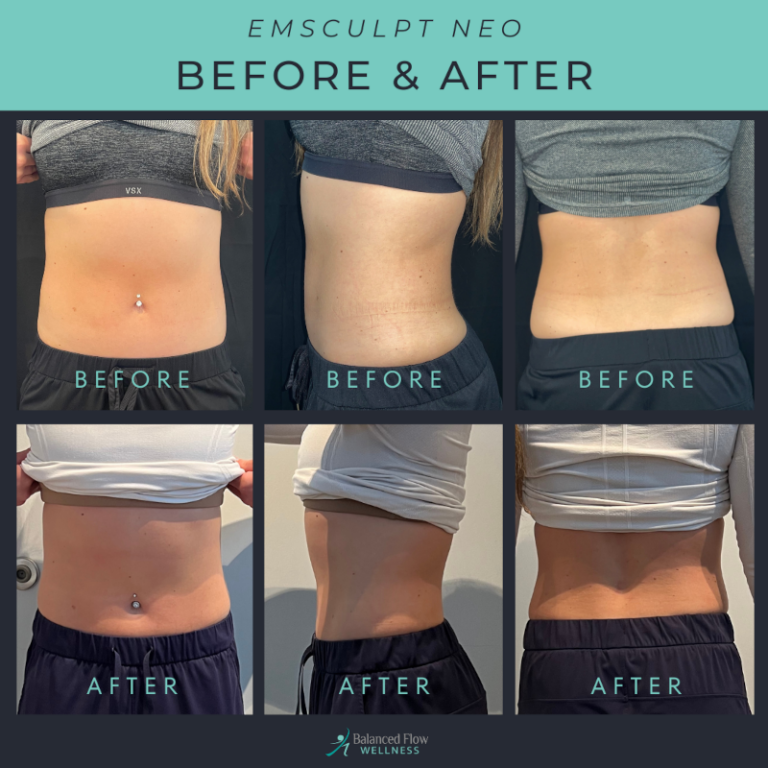 Before & After Archive - Balanced Flow Wellness